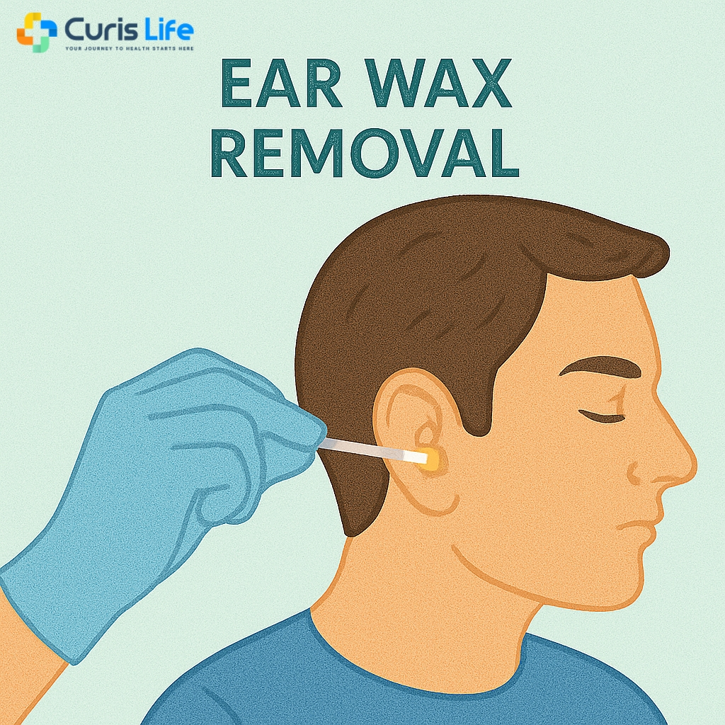 Ear Wax Removal in Andheri West | Curis Life Multispeciality Clinic