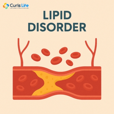 Expert Lipid Disorder Care in Andheri West | Curis Life Multispecialty ...