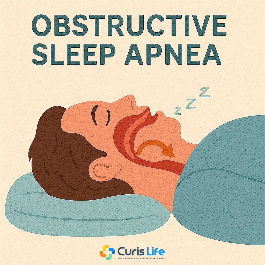 Comprehensive Obstructive Sleep Apnea Treatment in Andheri West | Curis ...