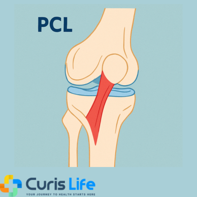 Advanced PCL Surgery in Andheri West | Curis Life Clinic