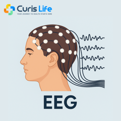 EEG Test (Electroencephalogram) in Andheri West | Curis Life Clinic